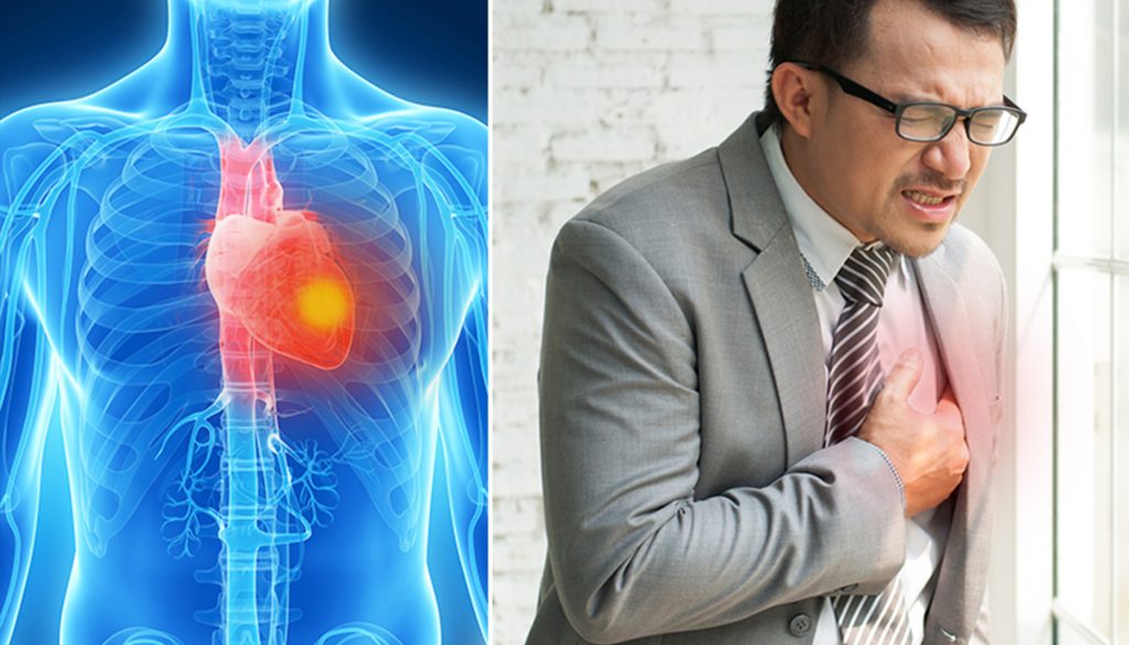 Pourquoi l'échographie cardiaque est-elle importante pour votre santé ...