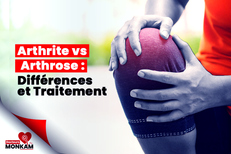 Arthrite vs Arthrose : Différences et options de traitement - Docteurs ...
