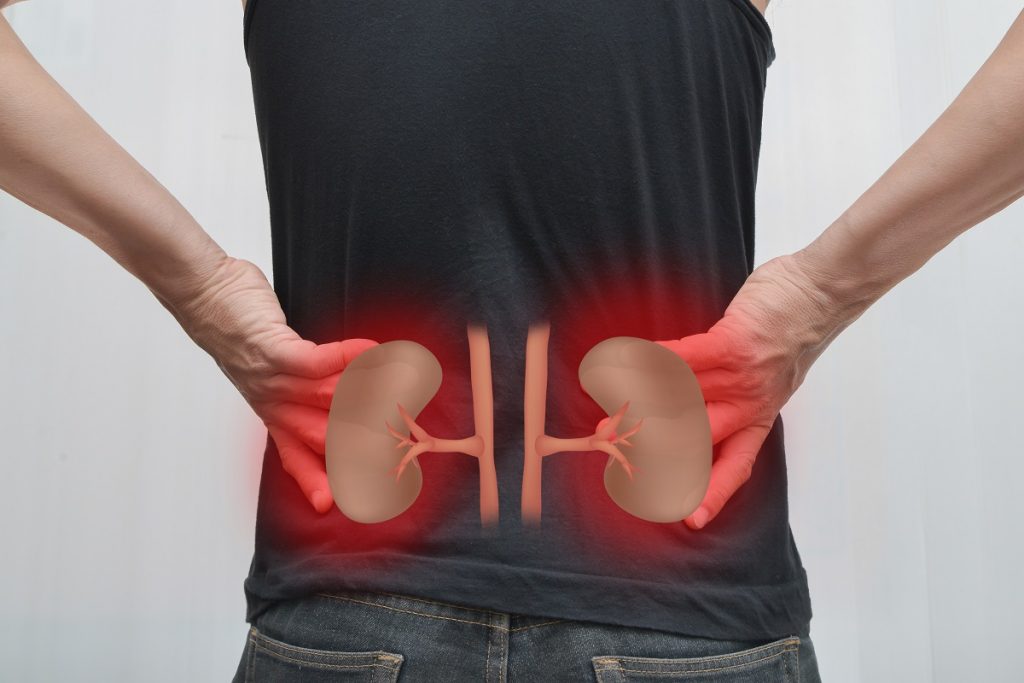 La cystinose : causes, diagnostic, traitement - Docteurs Monkam