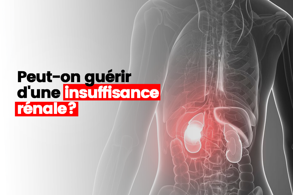 Est-ce qu'on peut guérir d'une insuffisance rénale ? - Docteurs Monkam