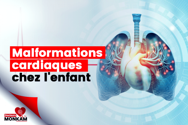 Malformations cardiaques chez l'enfant - Docteurs Monkam
