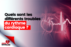 Quels sont les différents troubles du rythme cardiaque ? - Docteurs Monkam